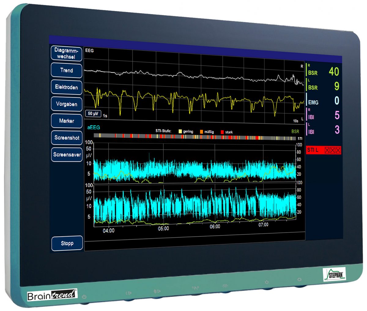 Neonatologie - Fritz Stephan GmbH